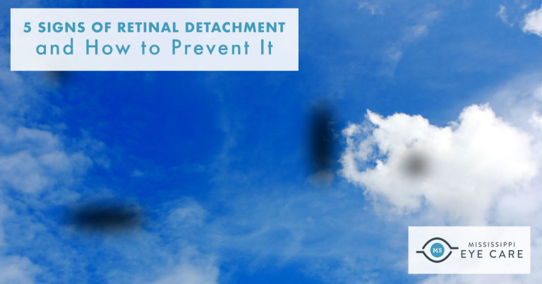 5 Signs of Retinal Detachment and How to Prevent It - Mississippi Eye Care